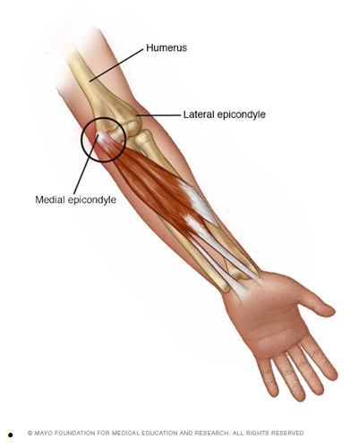 Golfer's Elbow - iHomeRehab
